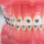 Roeder Orthodontics | Orthodontist in Asheville, NC