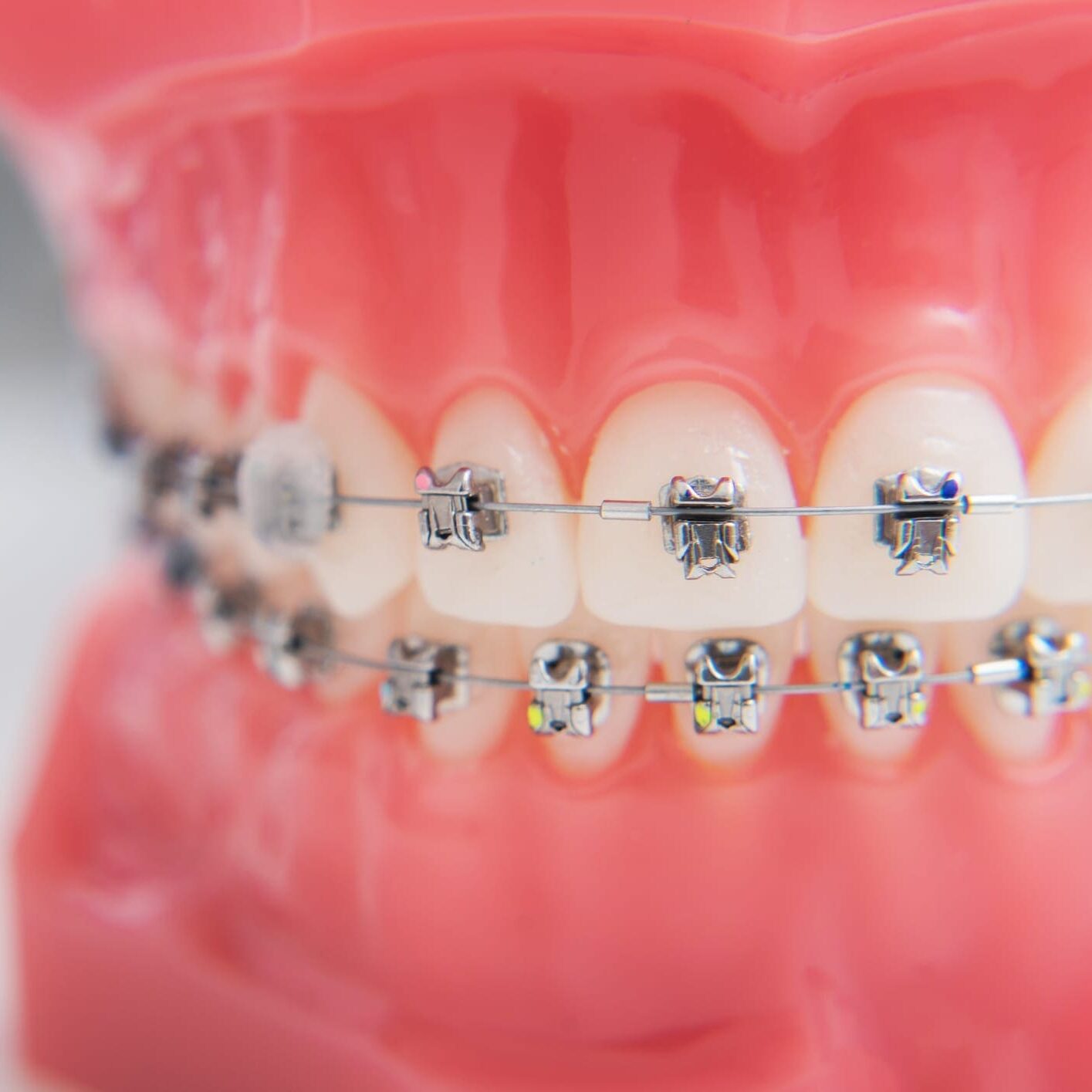 Roeder Orthodontics | Orthodontist in Asheville, NC